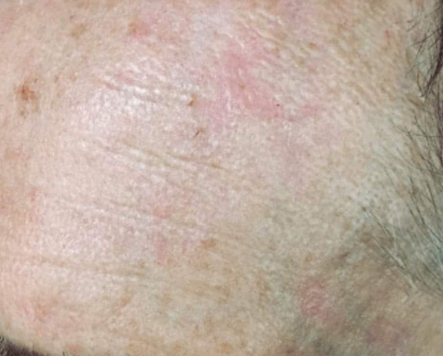 Skin Conditions And Antiaging | Integra Health & Wellness