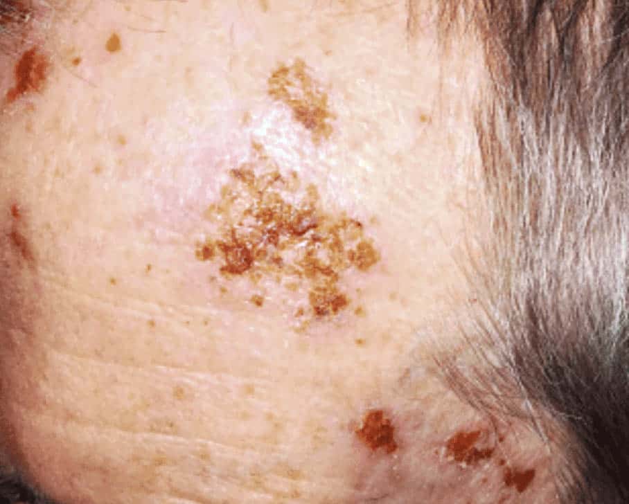 Skin Conditions And Antiaging | Integra Health & Wellness